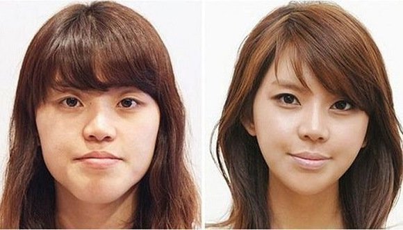 These Dramatic Plastic Surgeries Take Body Modifications To The Next ...