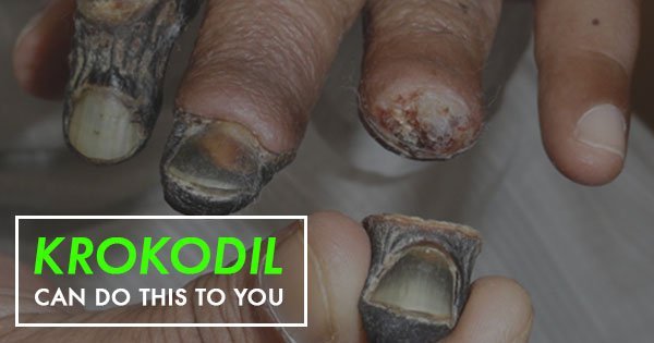 Here Are 10 Of The Scariest Drugs In The World - ScoopWhoop