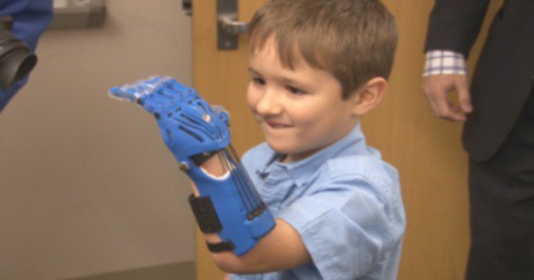Watch: 6-Year-Old Was Born Without A Hand, So They Gifted Him A 3D ...