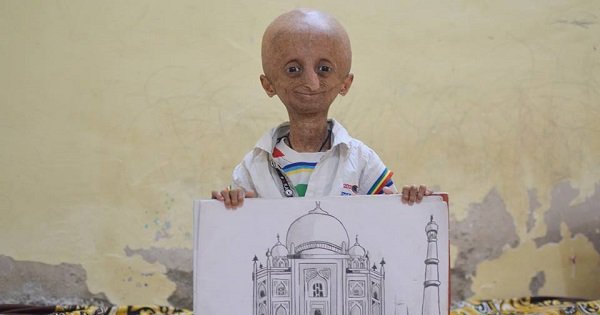 More Power To Him: Progeria Patient Nihal Bitla Has A Rare, Inspiring ...