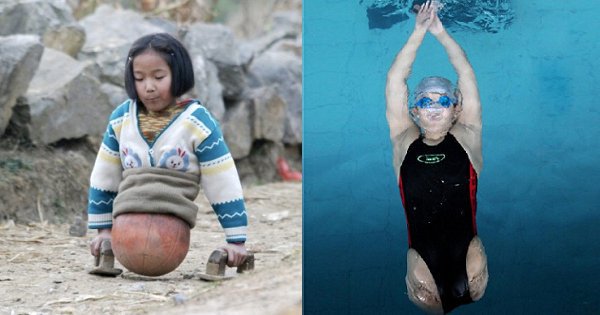 The Inspiring Story Of The Amputee Swimming Champion Who Did Not Lose ...