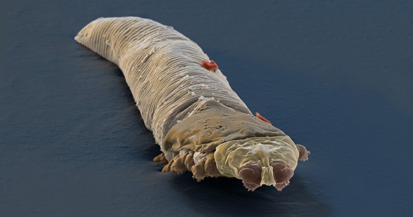 It’s Alarming To Know That This Creature Lives On Your Body & You’ll Be ...