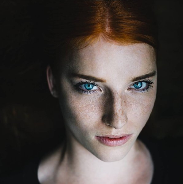 These Mesmerising Photos Of People With Freckles Show That Beauty Is ...