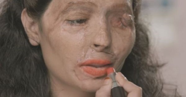 This Video Of An Acid Attack Survivor Giving Beauty Tips Has Won An ...