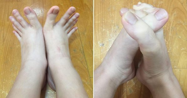 The Internet Can’t Get Over This Woman’s Toes That Are Almost As Long ...