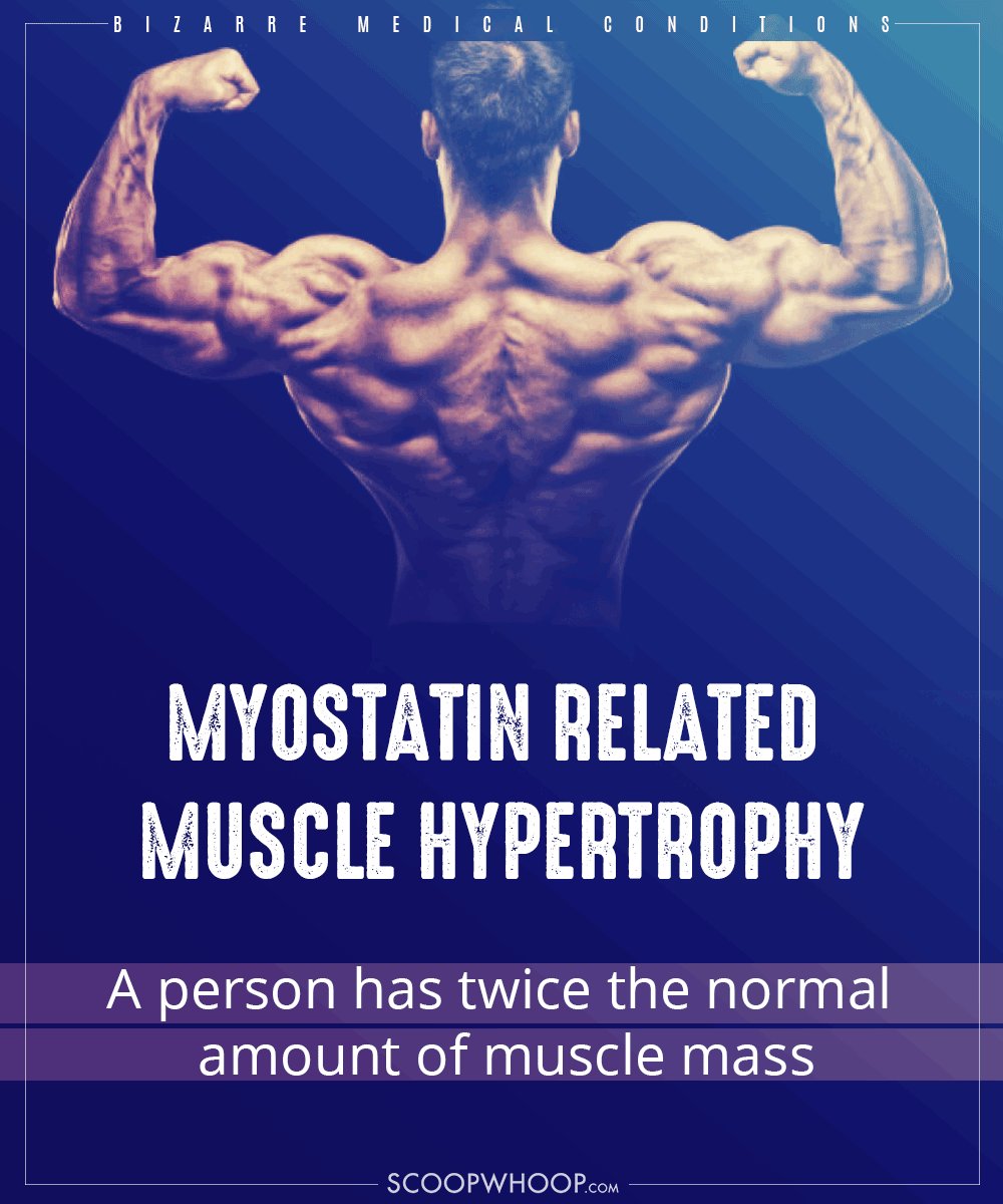 15 Rare Medical Conditions That Are As Bizarre As They Are Fascinating