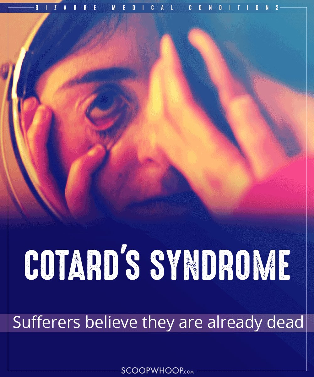 15 Rare Medical Conditions That Are As Bizarre As They Are Fascinating