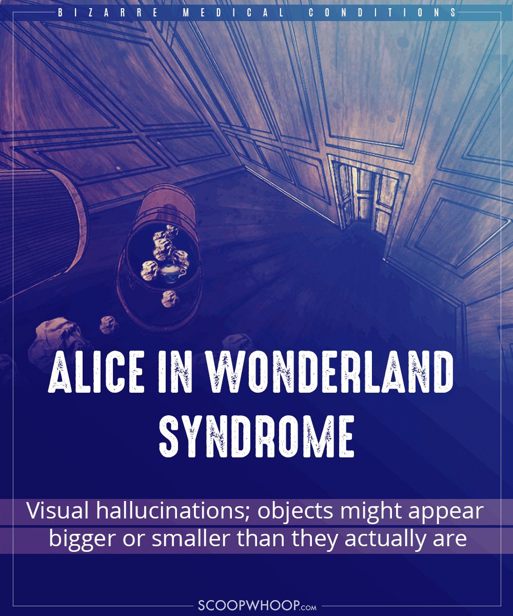 15 Rare Medical Conditions That Are As Bizarre As They Are Fascinating