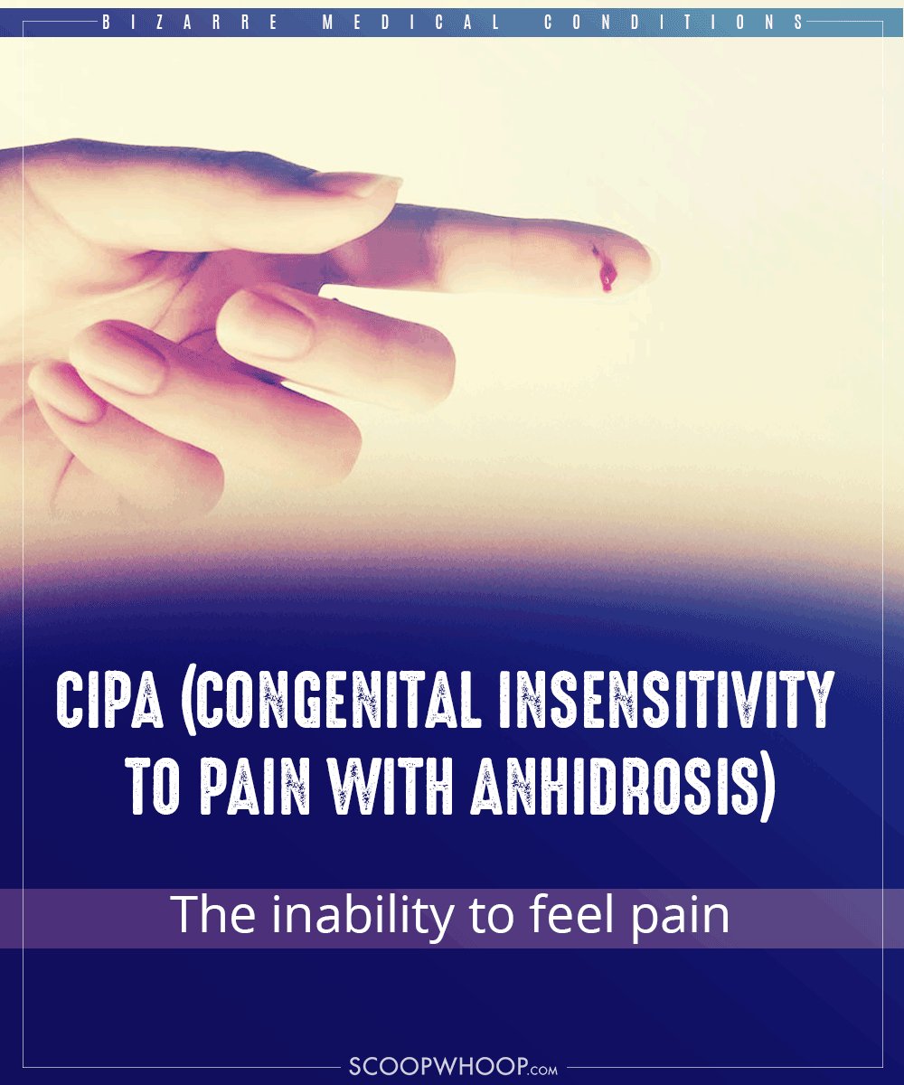 15 Rare Medical Conditions That Are As Bizarre As They Are Fascinating