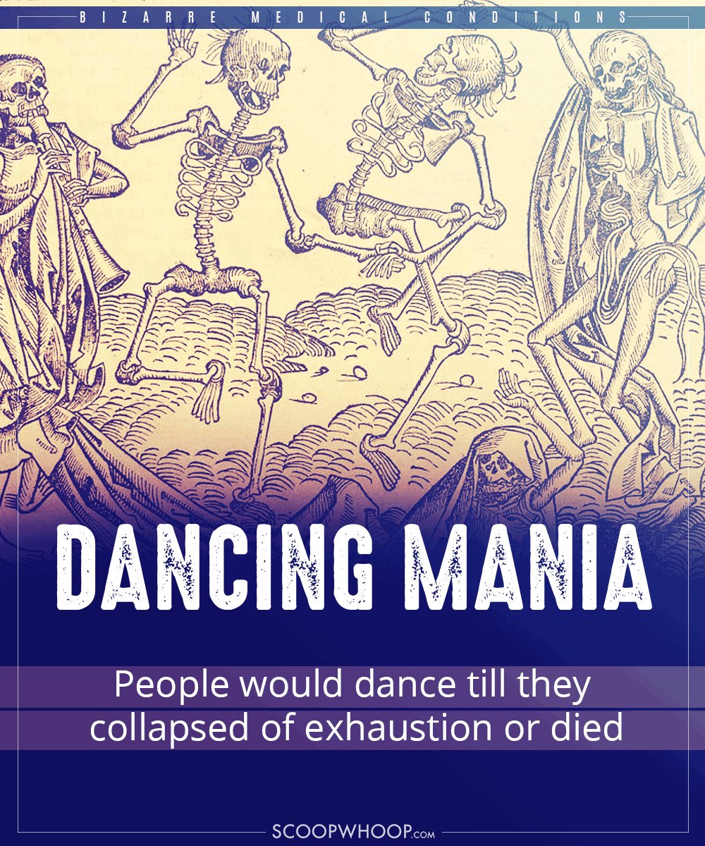 15 Rare Medical Conditions That Are As Bizarre As They Are Fascinating