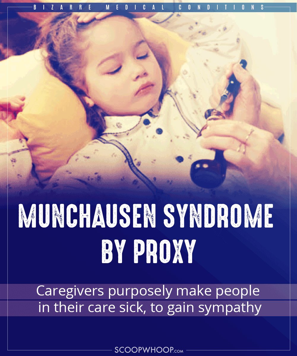 15 Rare Medical Conditions That Are As Bizarre As They Are Fascinating