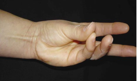 10 Most Rare Body Features That You Should Know About Them