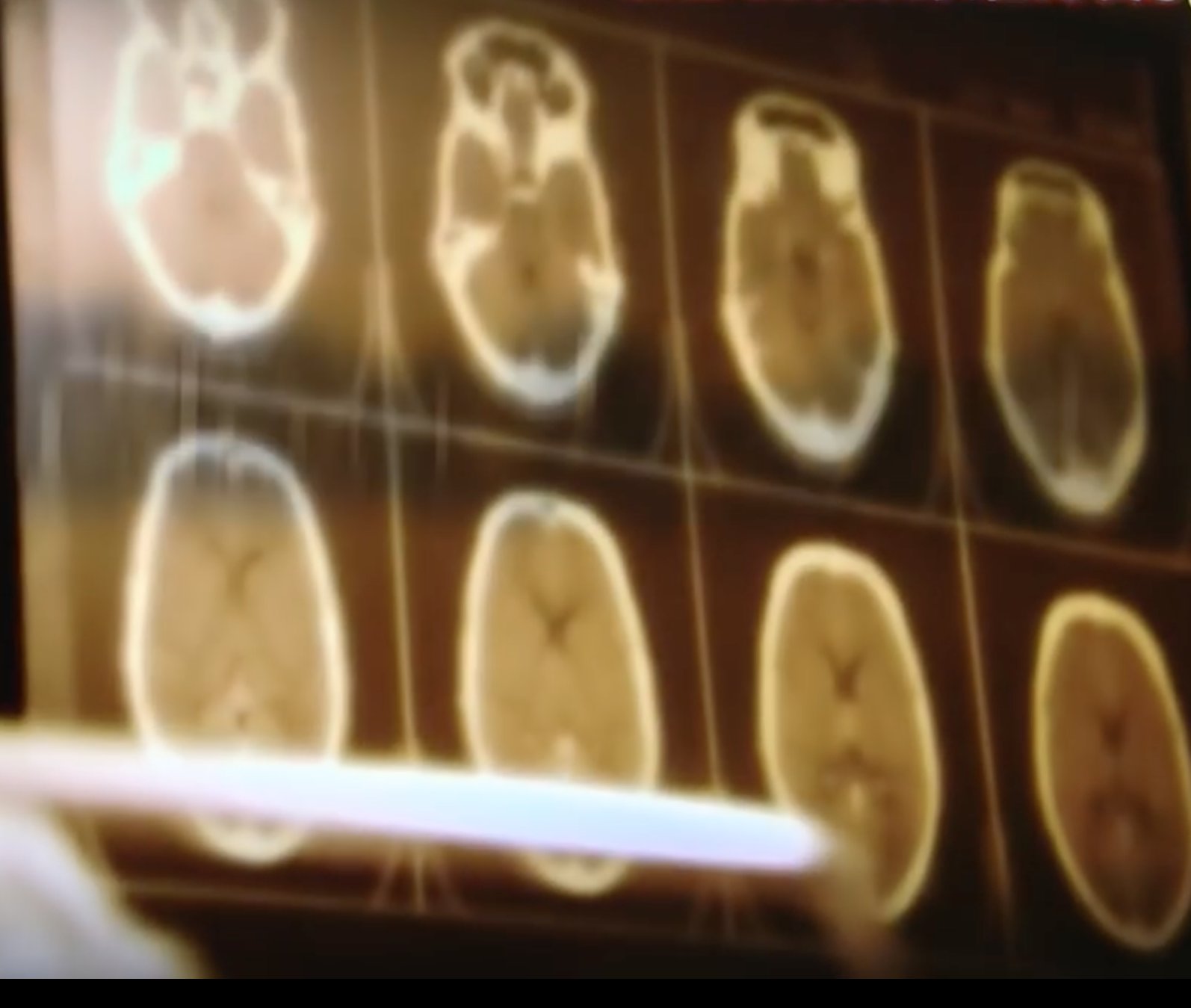 After She Lost Her Memory, Her Boyfriend Reminds Her Why They Fell In ...