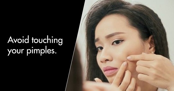 10 Tips That Will Help You Get Acne Free Skin