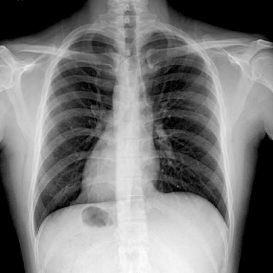 UP Man Found With Rare Condition With All His Organs On The Wrong Side