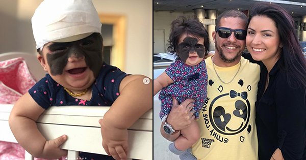 Born With A 'Batman Mask' Birth Mark, This 7-Month-Old Is Internet's ...