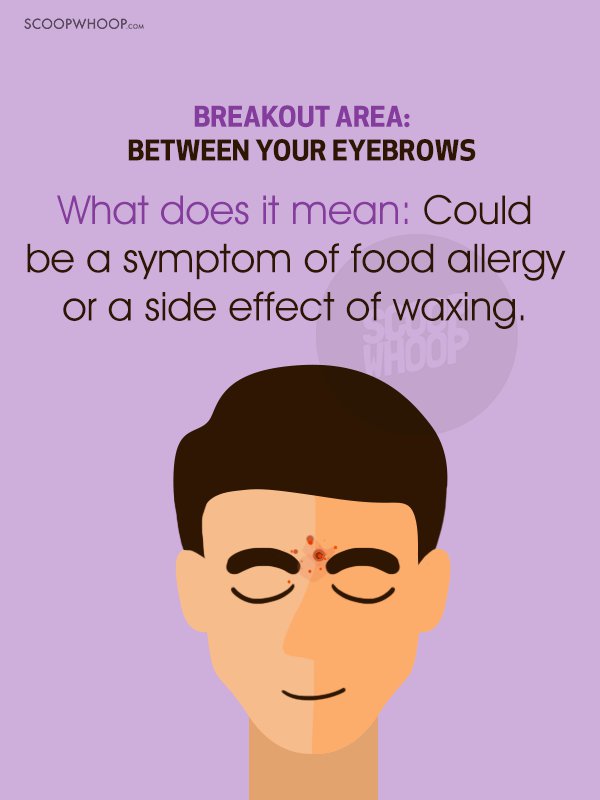 This Acne Face Map Will Help You Understand What The Placement Of Your ...