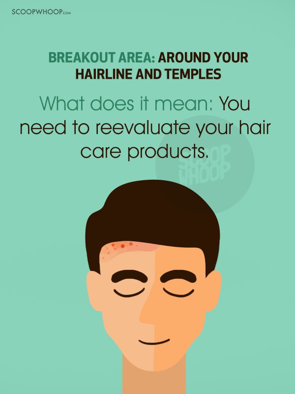 This Acne Face Map Will Help You Understand What The Placement Of Your ...