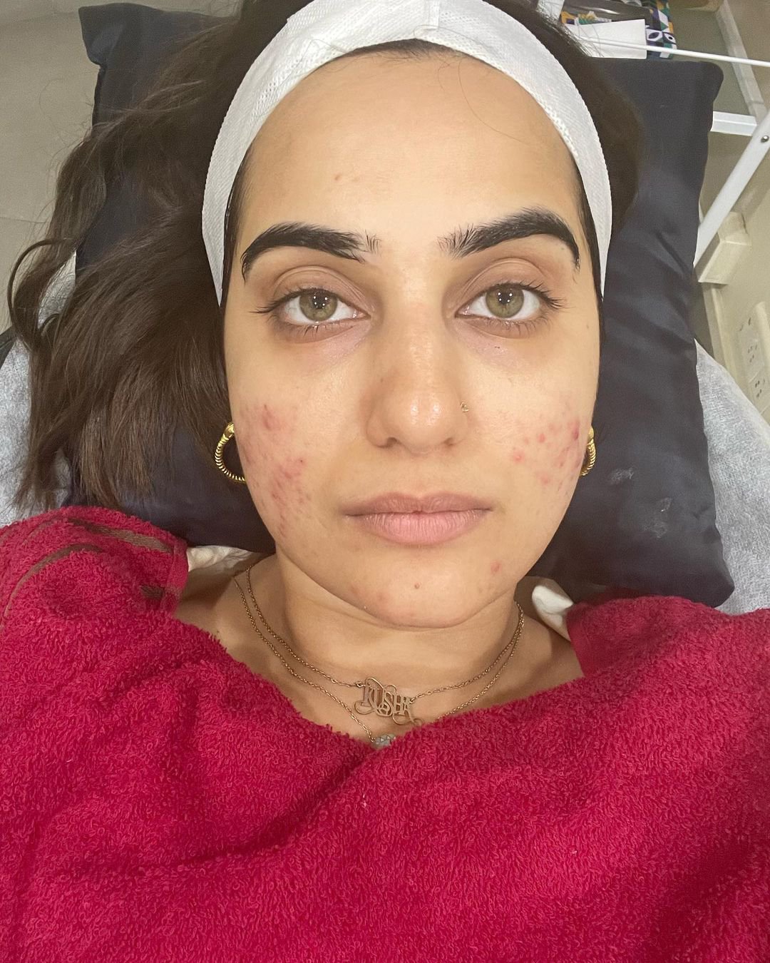 Kusha Kapila's Instagram Post On Hormonal Acne Is Raw, Real And Relatable